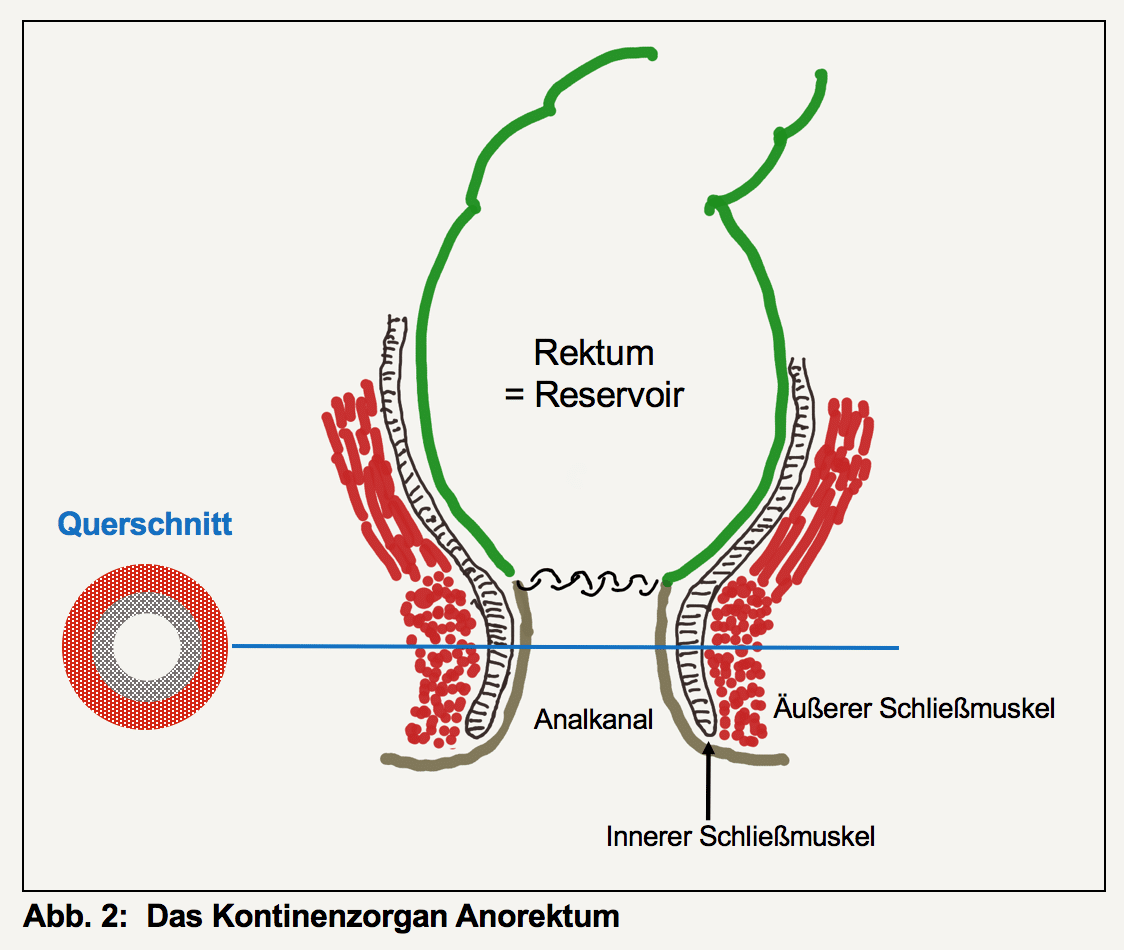 Stoma Rückoperation: Experteninterview - Physiotherapie Dr. Hochwimmer